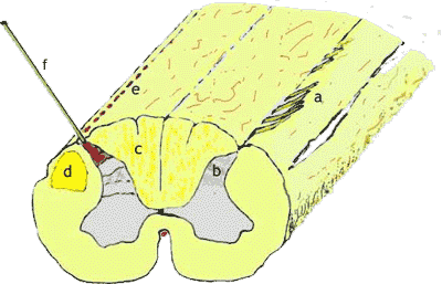 Pain – Dr Roger Melvill